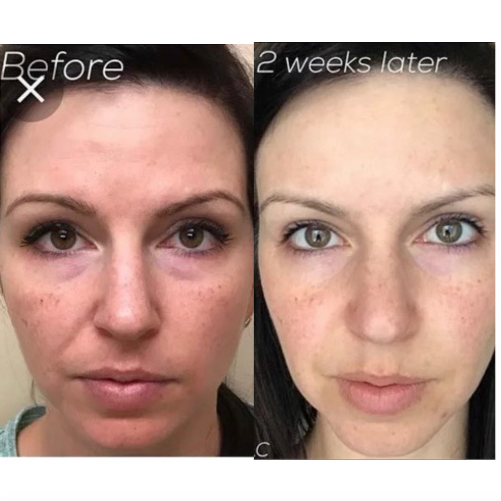 Skinlabus® Red and NIR Light Therapy System with Stand for Professiona